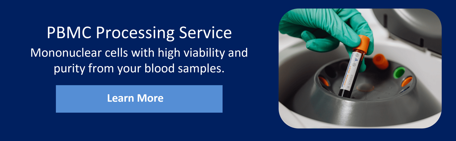 Protocol for PBMC isolation from buffy coat samples
